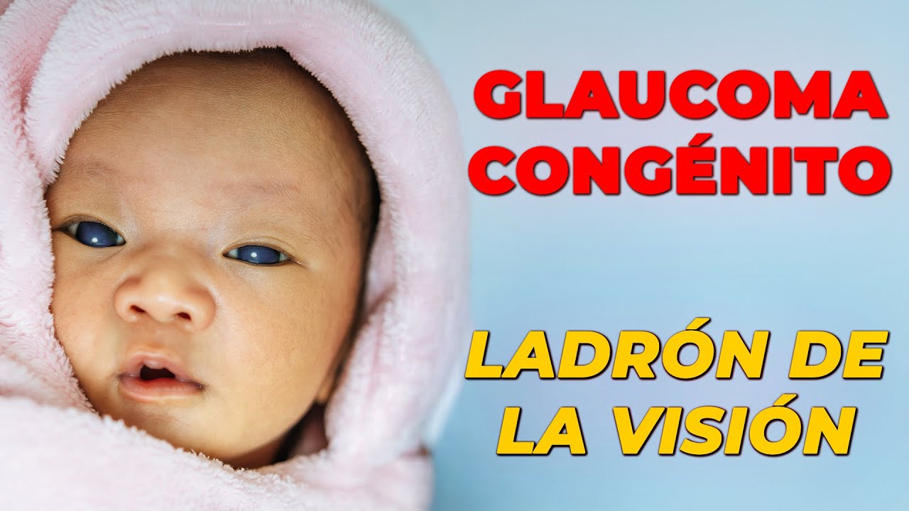Glaucoma Congénito: Cuando el tiempo decide la visión - YouTube