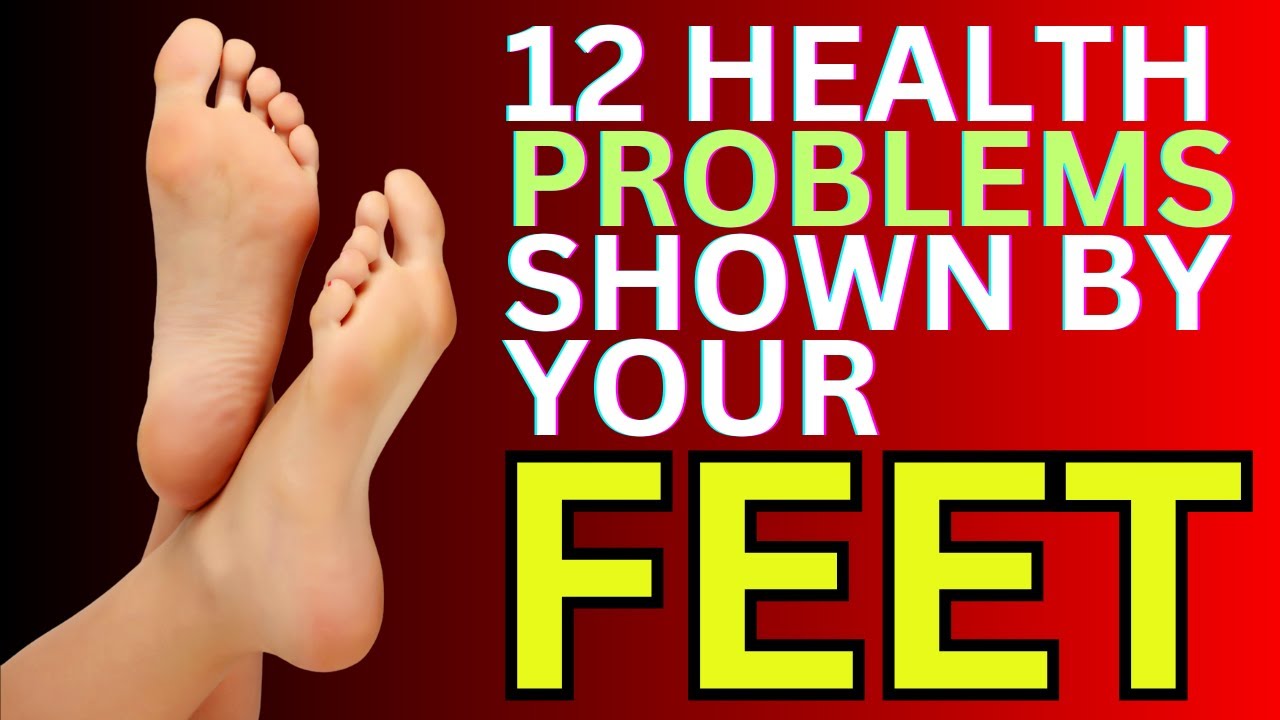 12 Health Problems Shown by Your Feet You Should Never Ignore! - YouTube