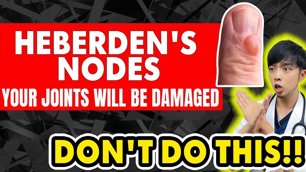 Stop Doing This! Make Heberden's Nodes Worse—Doctor Explains How to ...