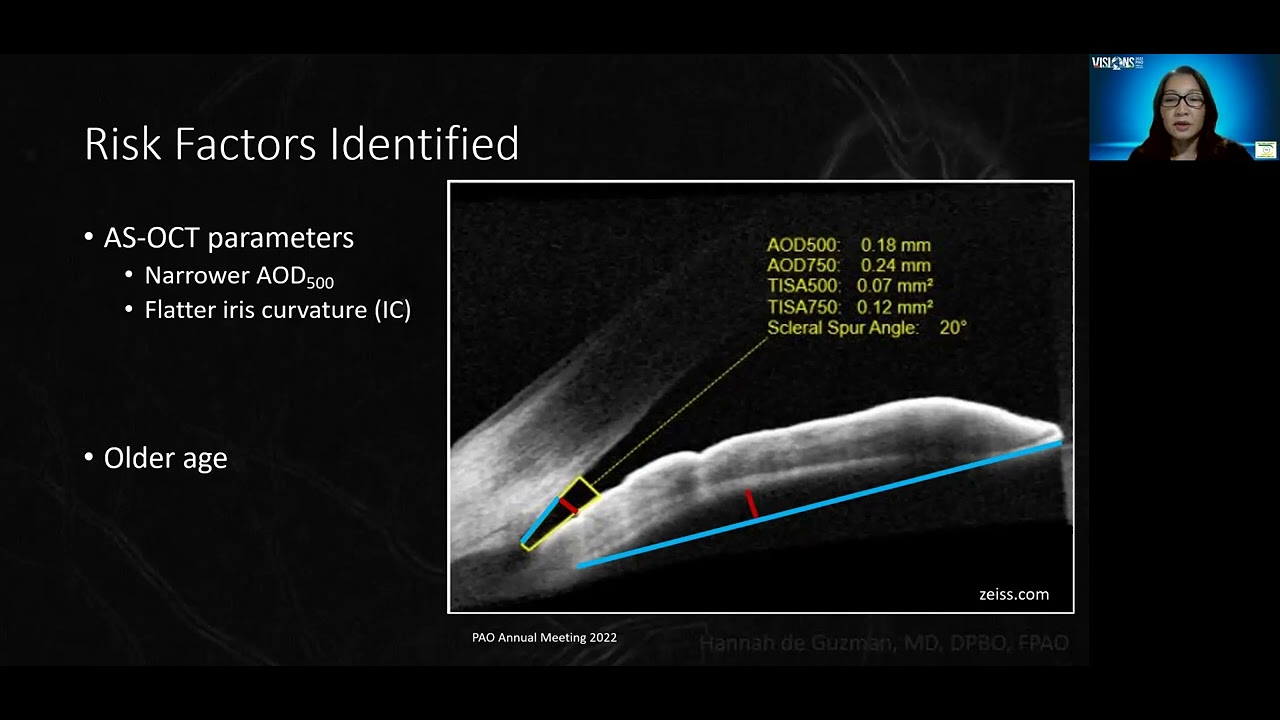 ZAP and EAGLE: Implications for Angle-Closure Management - YouTube