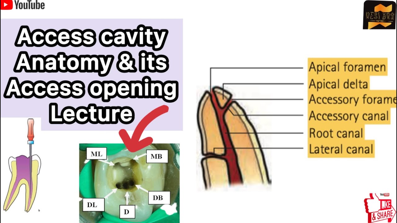 Anatomy of access cavity & pulp cavity full lecture video Desi BDS ...