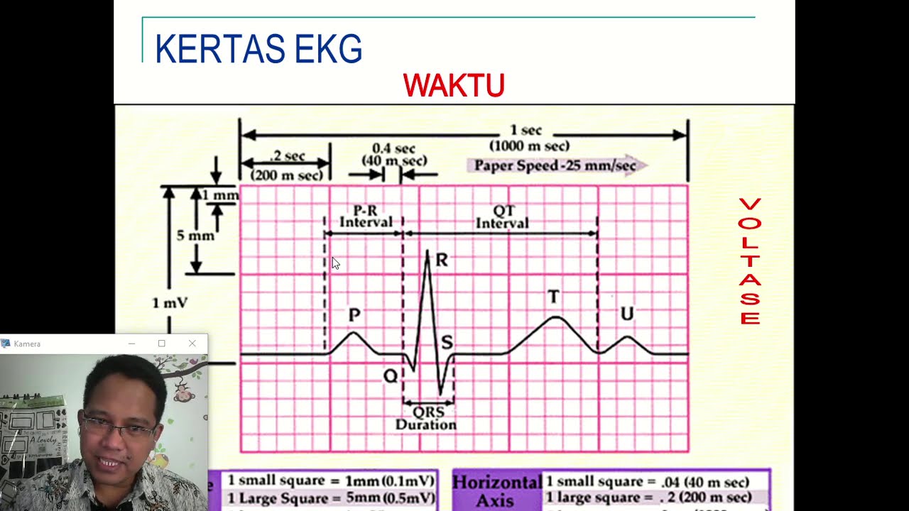 Elektrokardiografi (EKG) Bagian 2 - YouTube