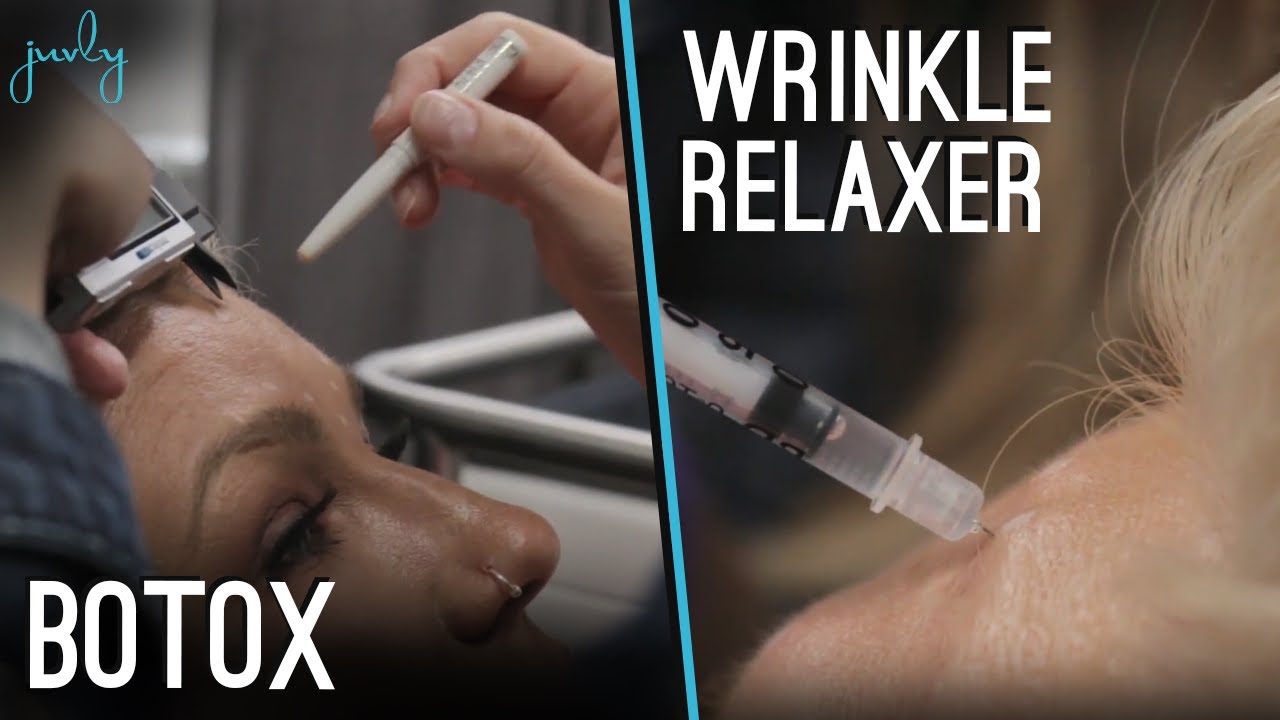 Botox Wrinkle Relaxer | See the Visible Results with Master Provider at ...