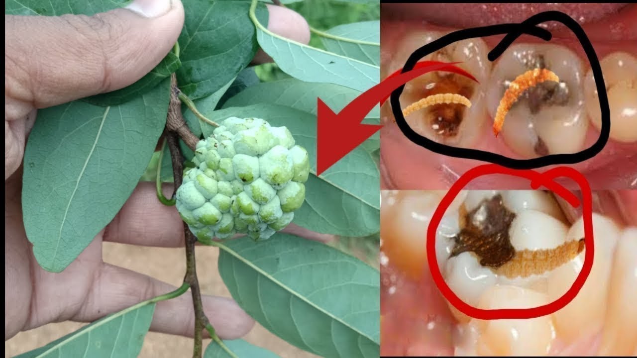 5నిమిషాల్లో మీ పంటిలో ఉన్న పురుగులు మొత్తం రాలి కిందపడాలంటే ఒక్కసారి ...