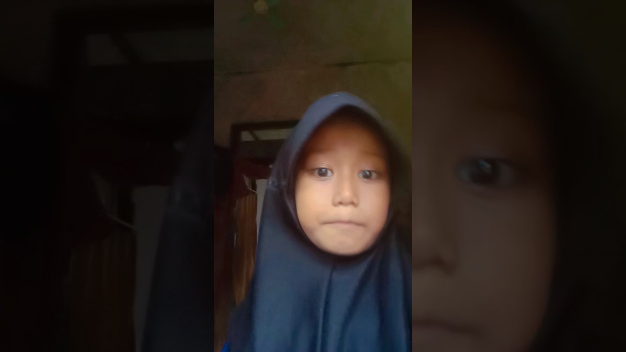 gigi ku wwrna kuning. dan ompong di bawah - YouTube