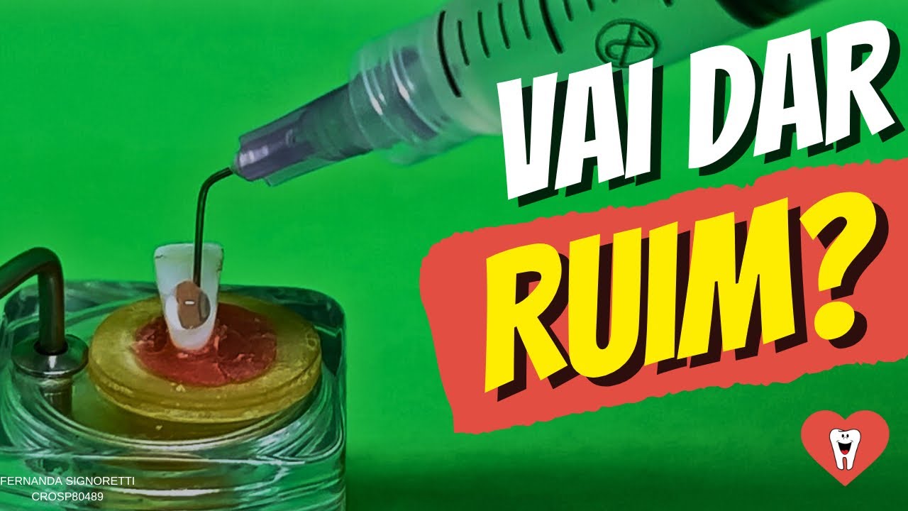 DOR FORTE NO CANAL DURANTE A IRRIGAÇÃO - MESMO COM ANESTESIA ...