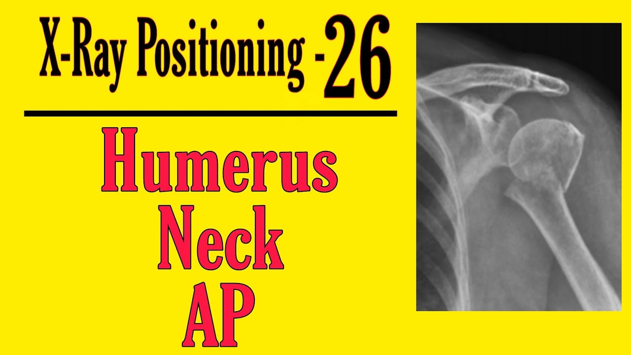 HUMERUS NECK AP POSITIONING HINDI | X RAY POSITIONING FOR RADIOGRAPHERS ...
