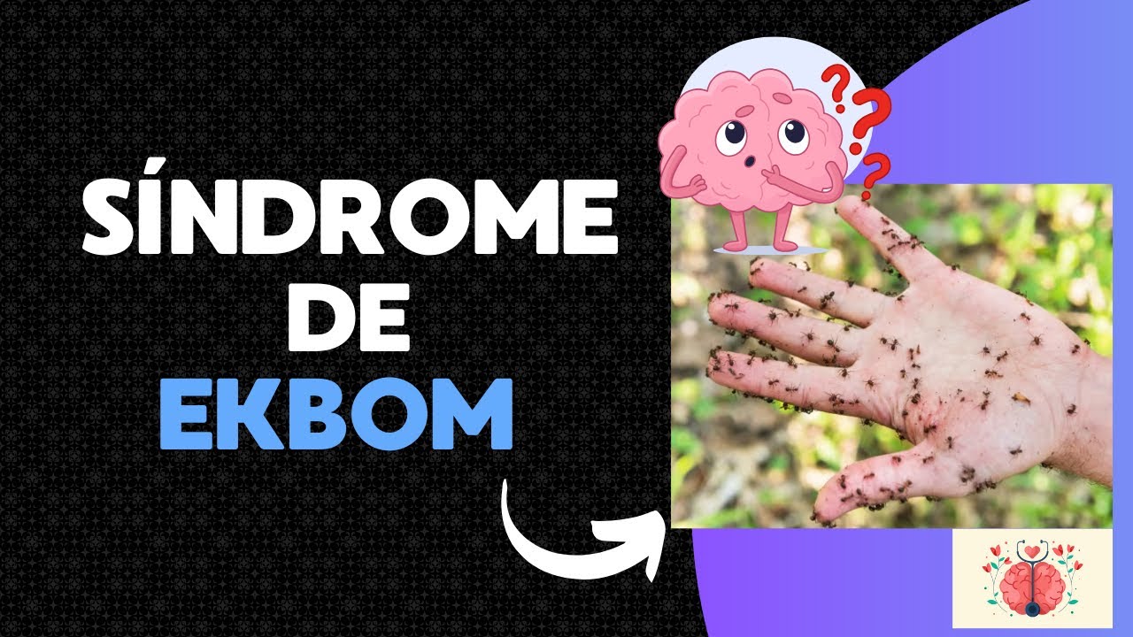 SINDROME DE EKBOM! CONOCE LOS SINTOMAS PRINCIPALES! #ansiedad # ...