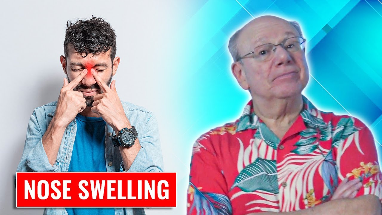 Nose Unbound: Acupressure Technique for Swelling Relief - YouTube