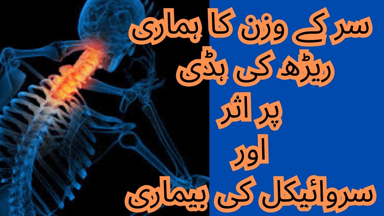 Effect of Smart phones & laptops on neck || cervical spondylitis ...