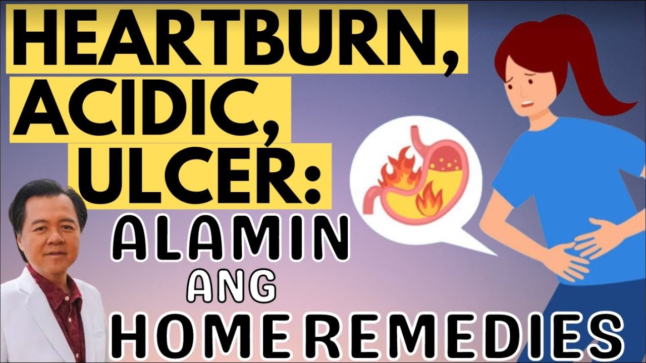 Heartburn, Acidic, Ulcer: Alamin ang Home Remedies. - By Doc Willie Ong ...