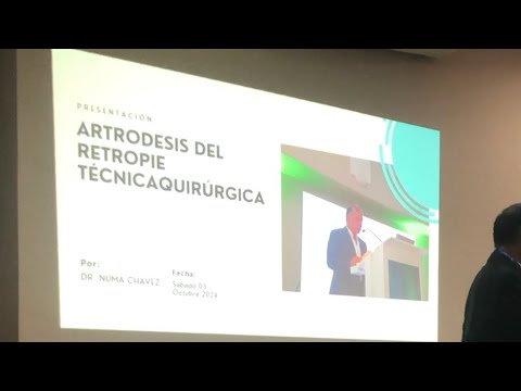 Artrodesis del Retropie (deformidades en el pie ) ( correcciones en el ...
