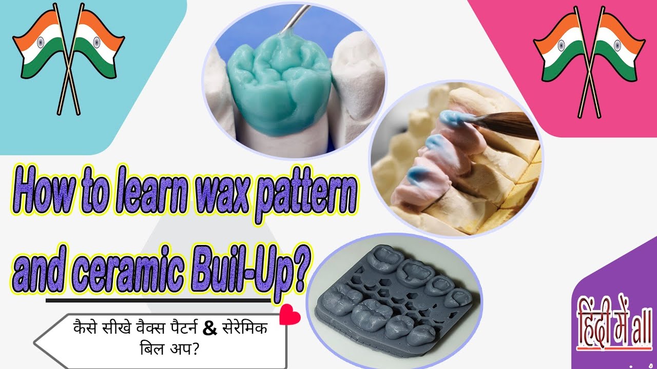 wax pattern crow & bridge | easy Build-up Technique | Ceramic Build-up ...