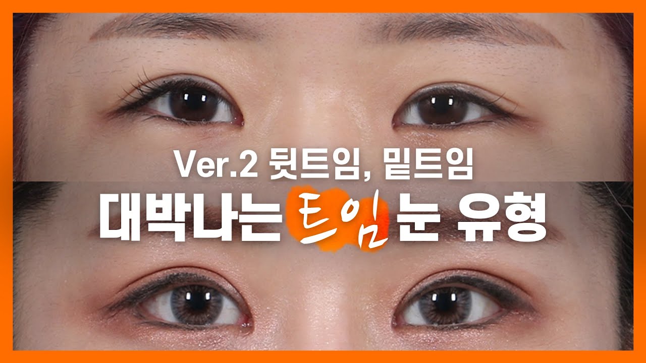 대박나는 트임 눈 2탄 과하지 않은 뒤트임 하는 방법 뒤트임 밑트임편 히트성형외과 눈성형 Youtube