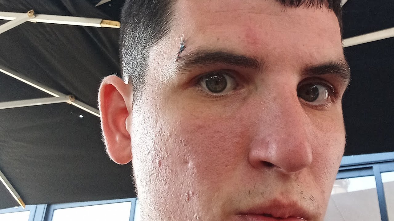 פרי פצוע 5 - YouTube