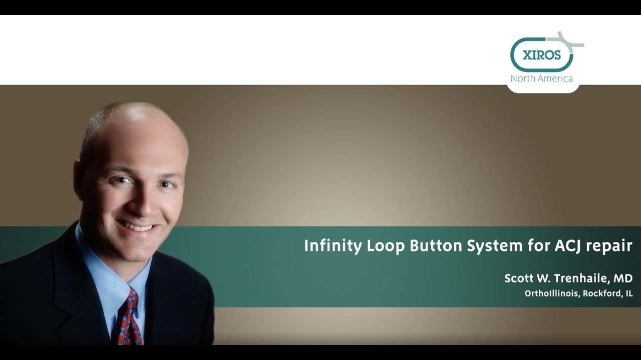 Infinity Loop Button System for ACJ Repair - YouTube
