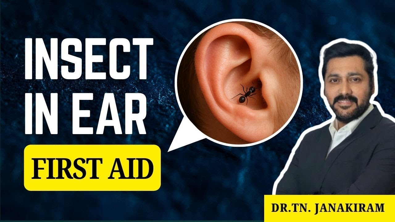 🚨 Insect in Ear? First Aid Steps You Must Know! 🦟👂 | #firstaid #ear # ...
