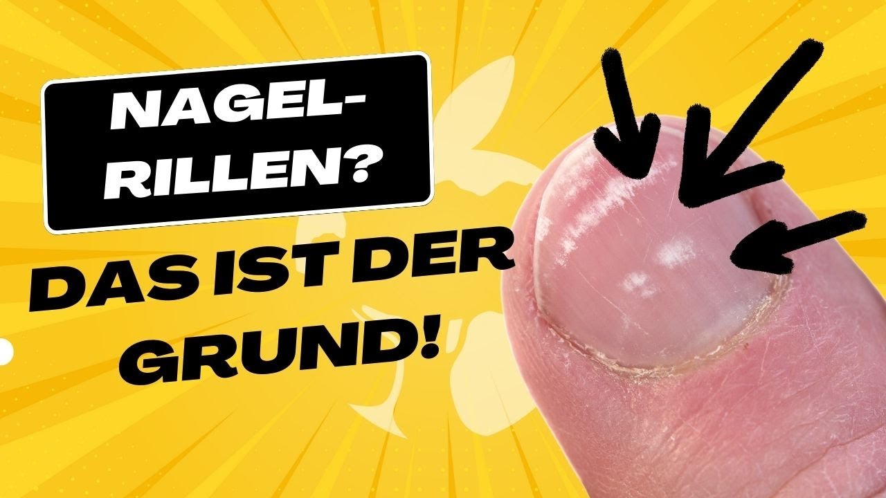 Vertikale Rillen in den Nägeln? Das ist der Grund! - YouTube