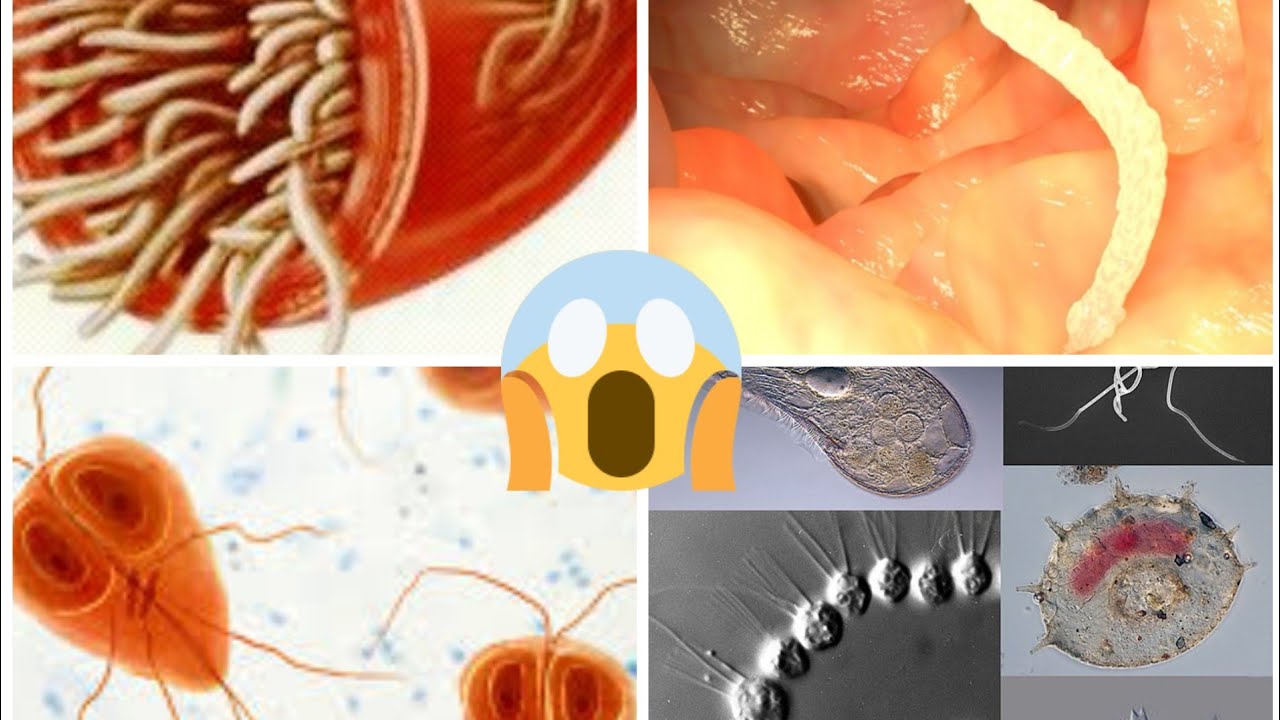 Cum putem scapa de parazitii care ne pun in pericol sanatatea ...