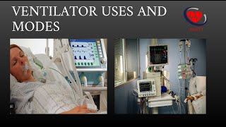 Mechanical Ventilator - Types Modes and Uses | Doovi