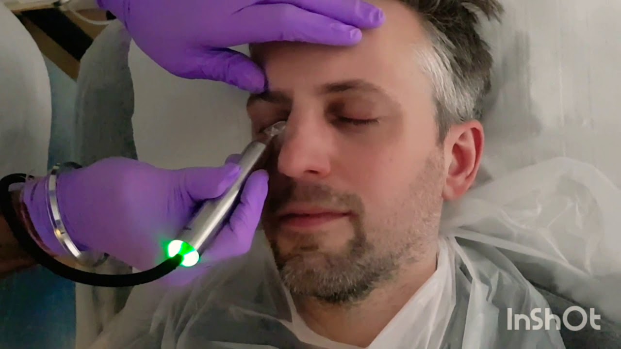 Heat Treatment using Mibo Thermoflo - YouTube