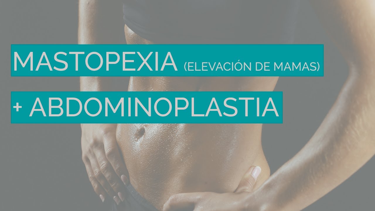 Mastopexia (elevación de pecho) y abdominoplastia - Cirugía Estética ...