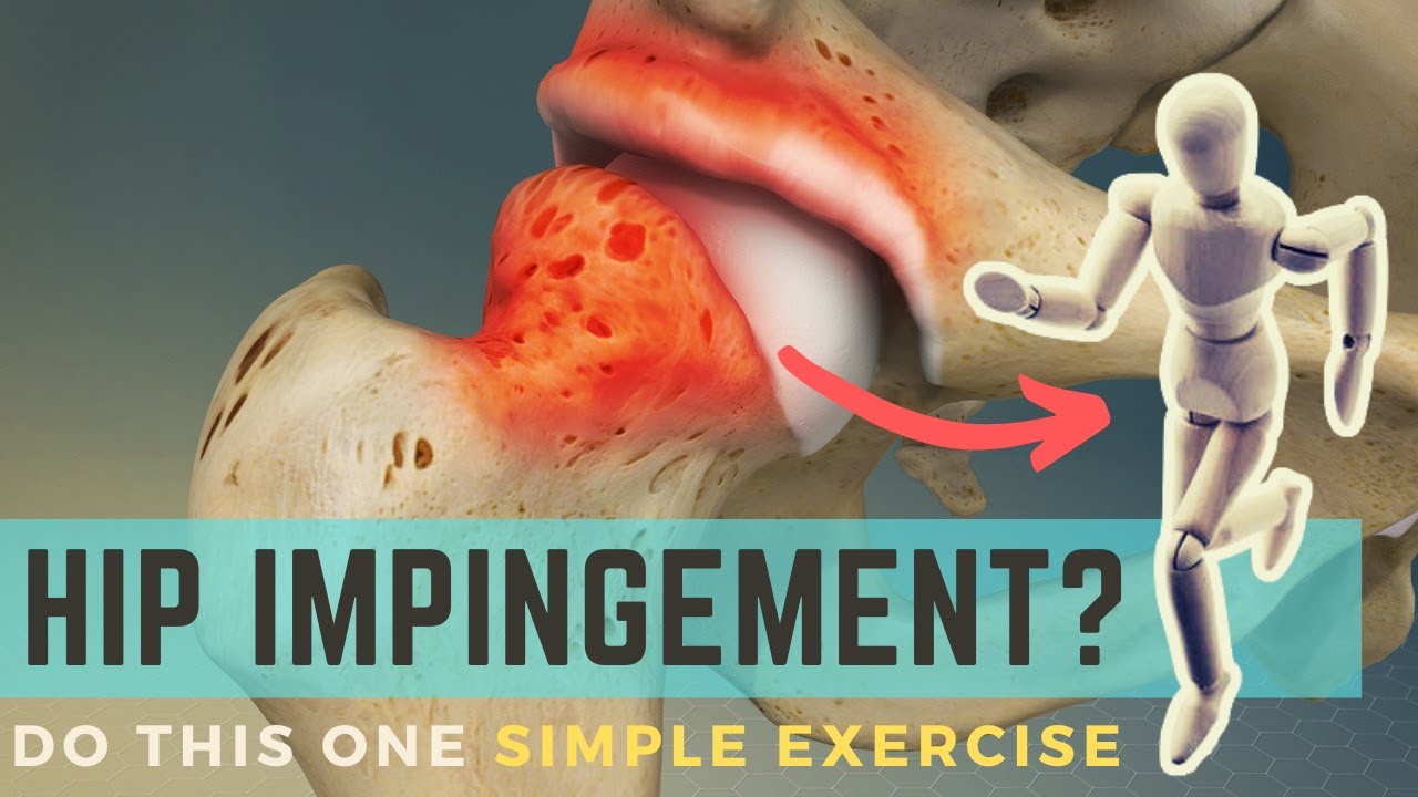 One Highly Effective Hip Impingement Exercise (Femoroacetabular ...