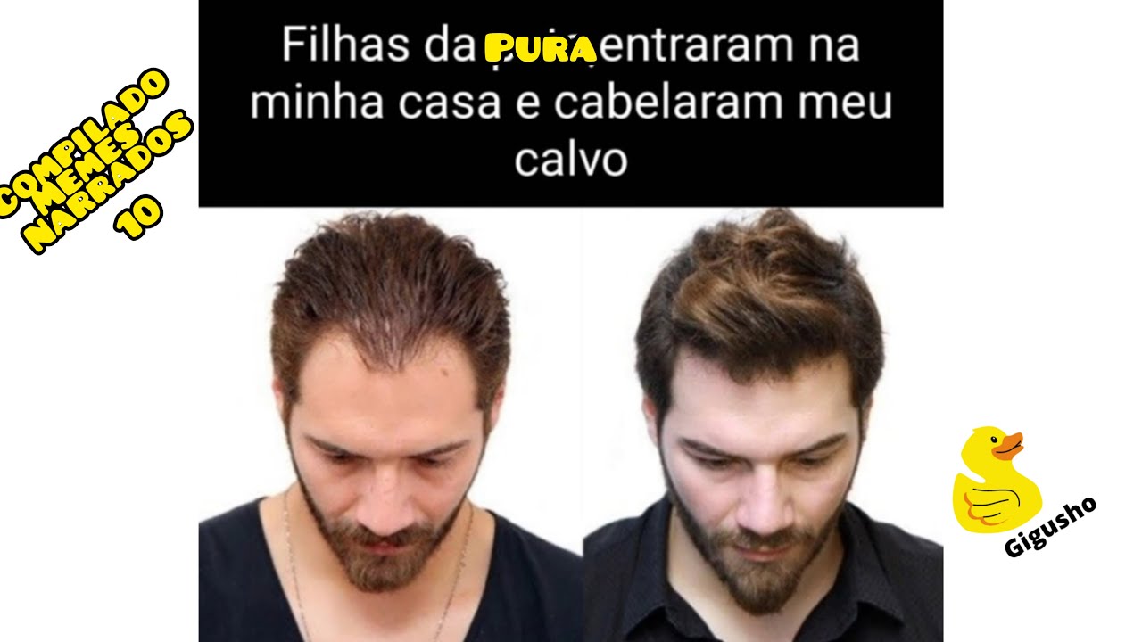 CABELARAM O MEU CALVO - Memes em imagem pra VIDA - compilado #memes ...