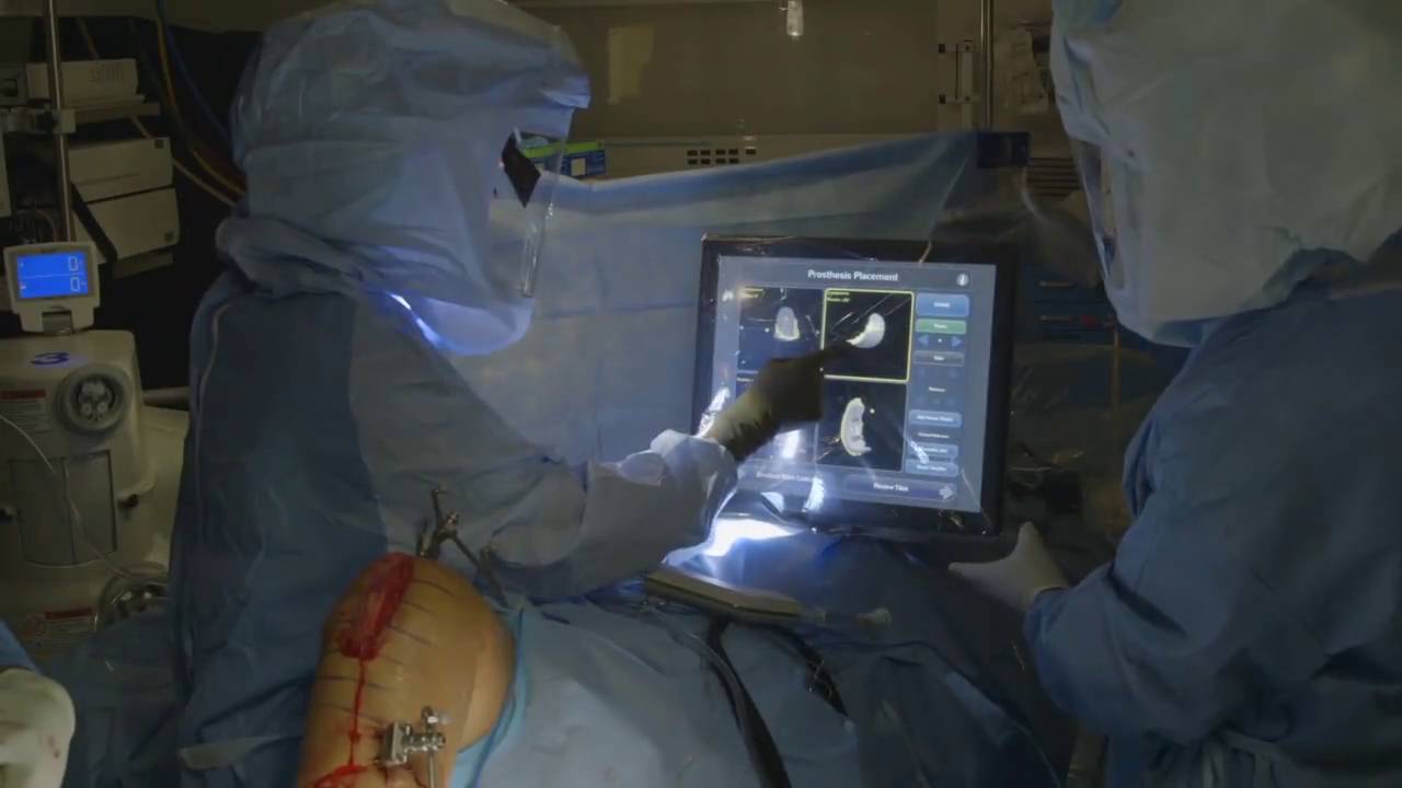 Navio Surgical System - YouTube