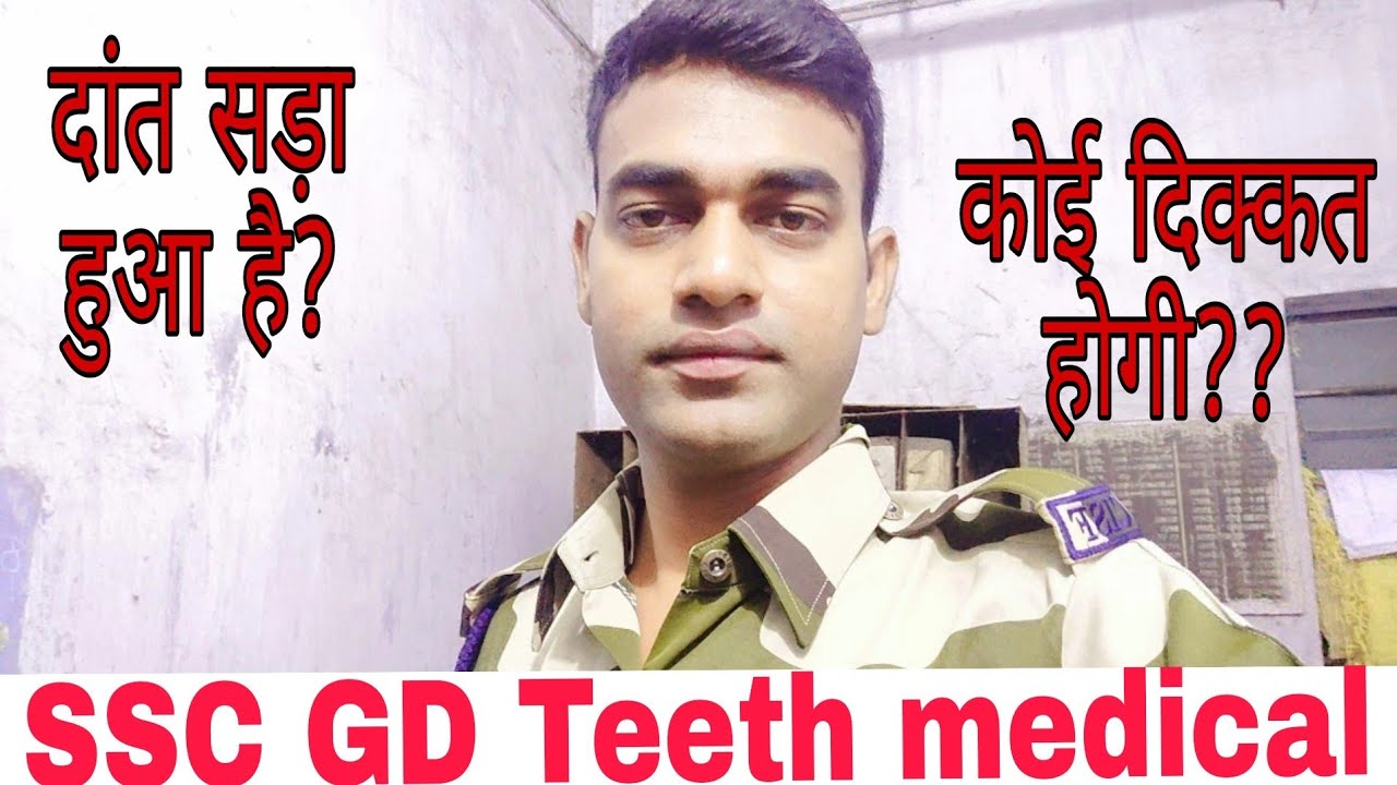 SSC GD medical me dant check kaise hota hai/ SSC GD teeth medical # ...