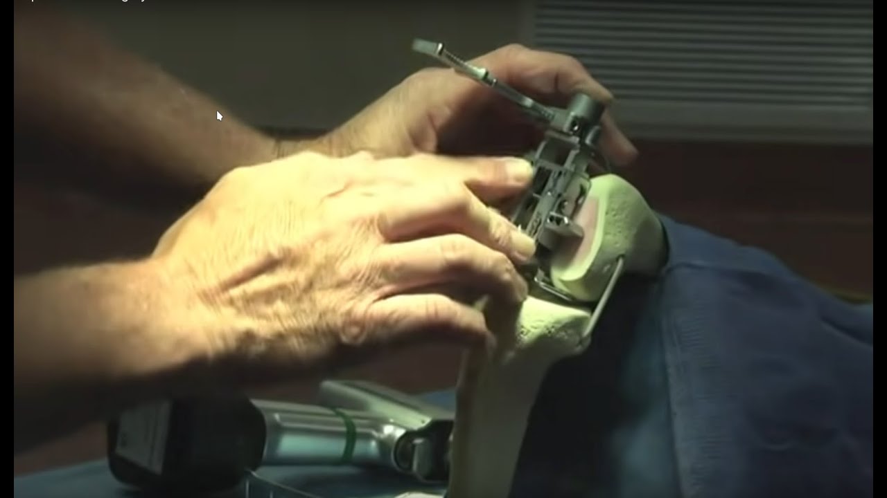 Total Knee Replacement Surgery Demonstration - YouTube