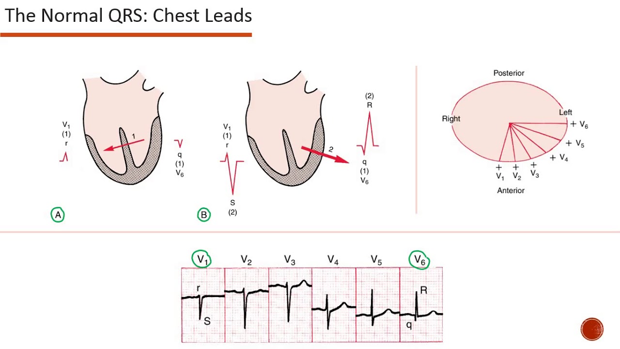 16) Normal QRS complex in chest leads - YouTube