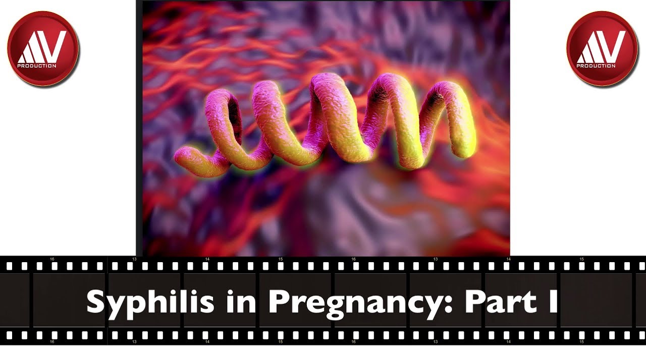 Syphilis in Pregnancy Part I - YouTube