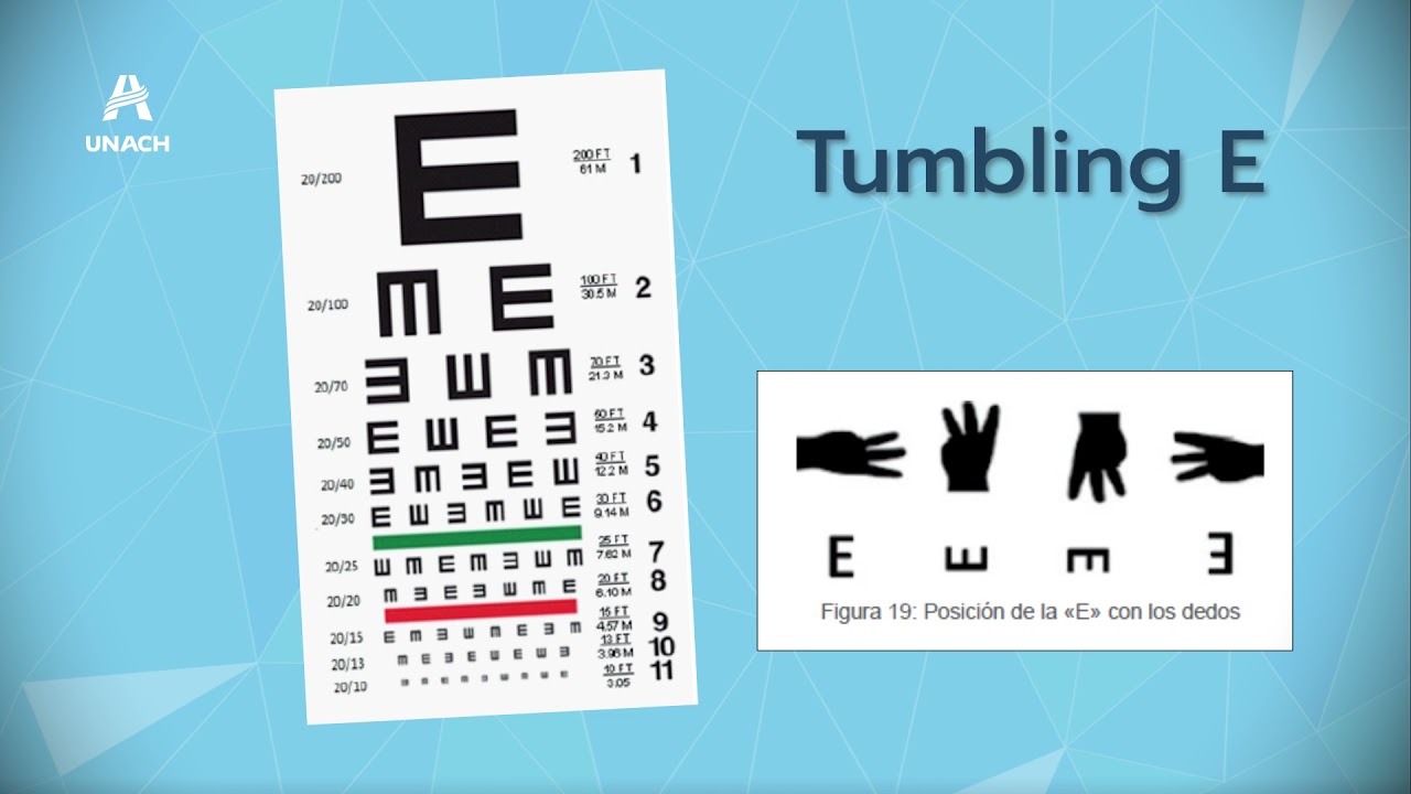 Examen Visual y test de adams - YouTube