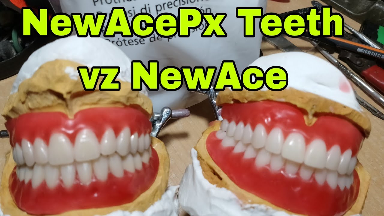 New Ace Px Composite Teeth and New Ace Acrylic Teeth. - YouTube