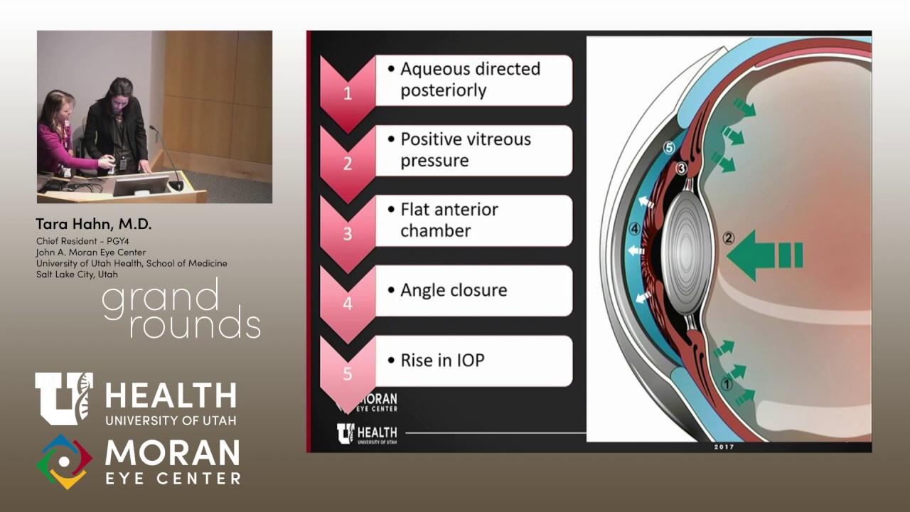 Aqueous Misdirection - YouTube