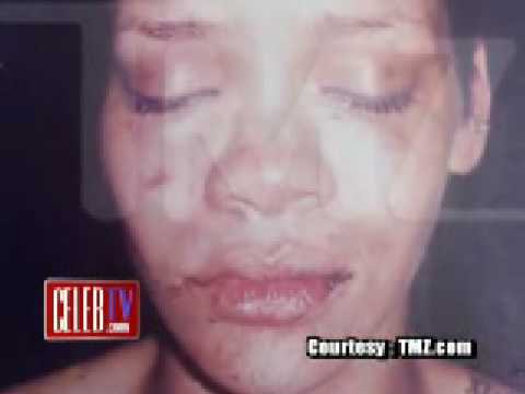Rihanna pic after Chris Brown hit her - YouTube