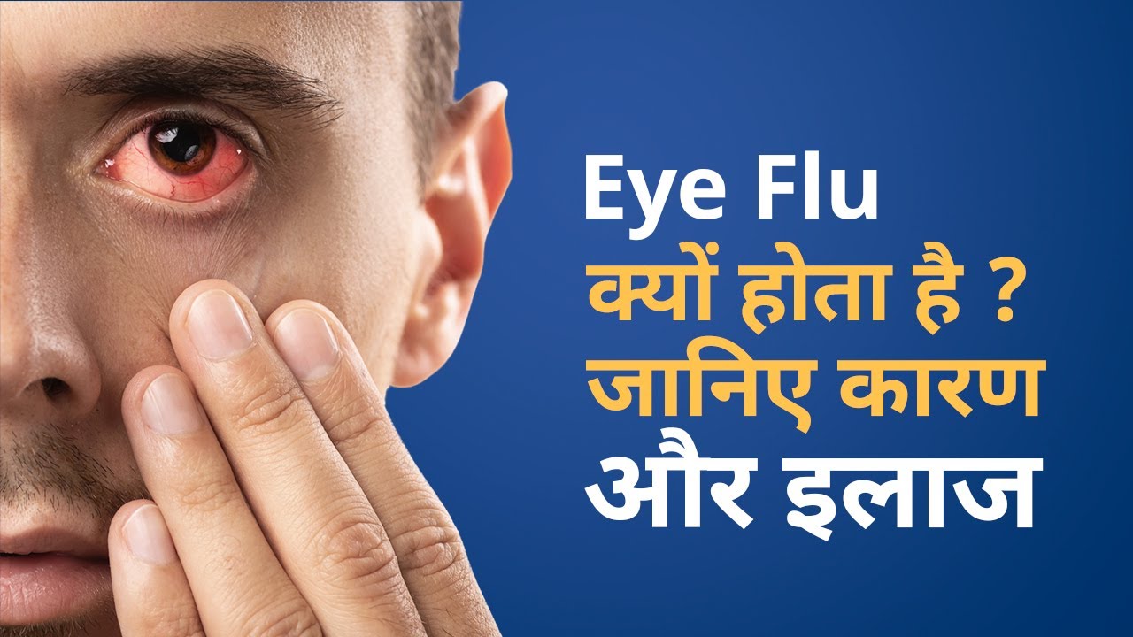 Pink Eye | Eye flu Treatment | Conjunctiva - Causes, Symptoms ...