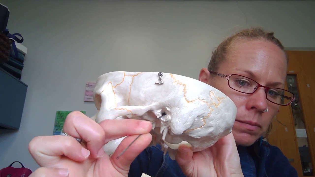 Skull Quiz Question - YouTube