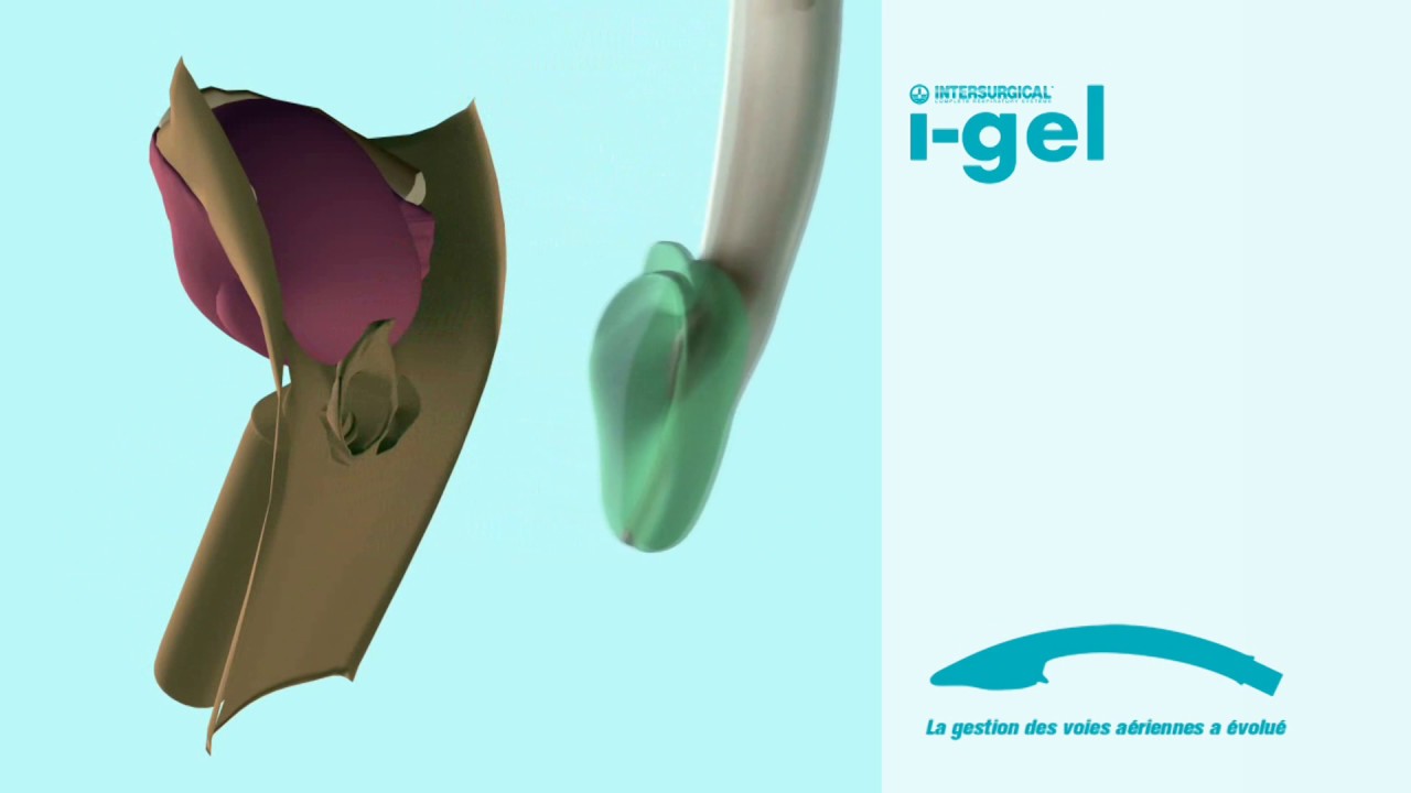 Igel dispositif supraglottique - Présentation i-gel - YouTube