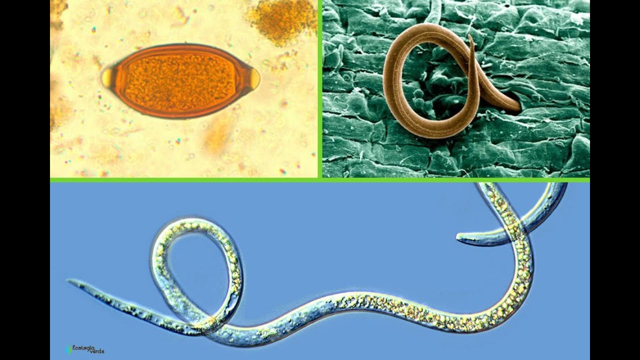 Nematodos del suelo - YouTube