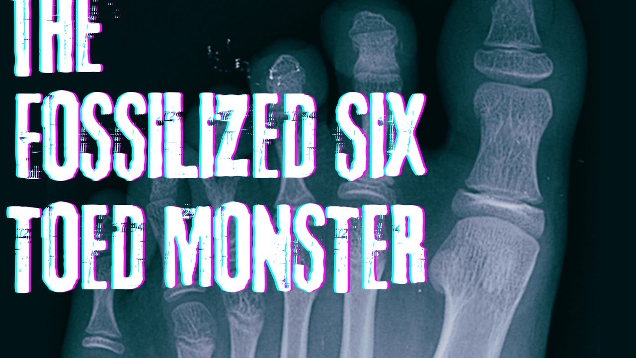 The Fossilized Six Toed Monster - YouTube