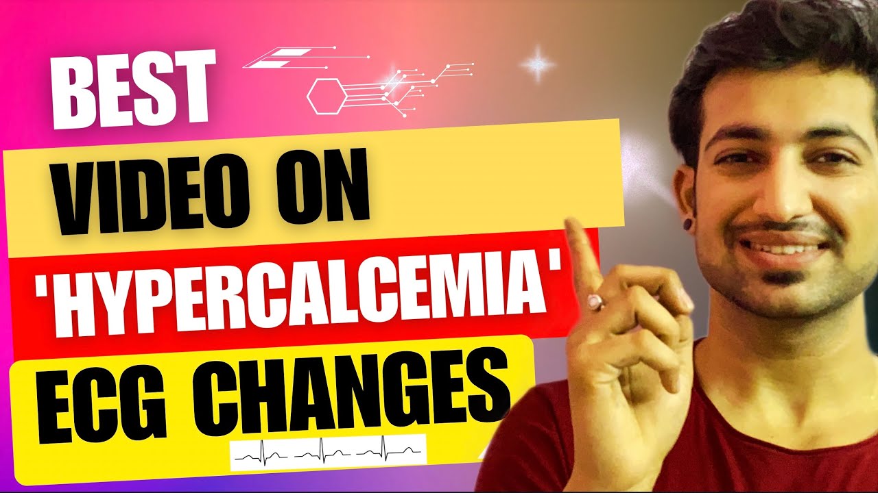 Hypercalcemia ecg |hypercalcemia ecg changes|hypercalcemia ecg on heart ...