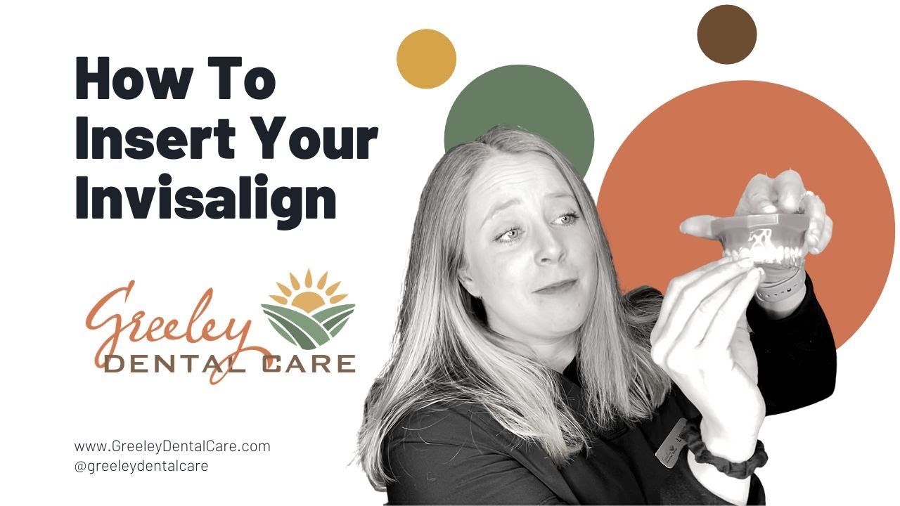 How to Insert Invisalign - YouTube