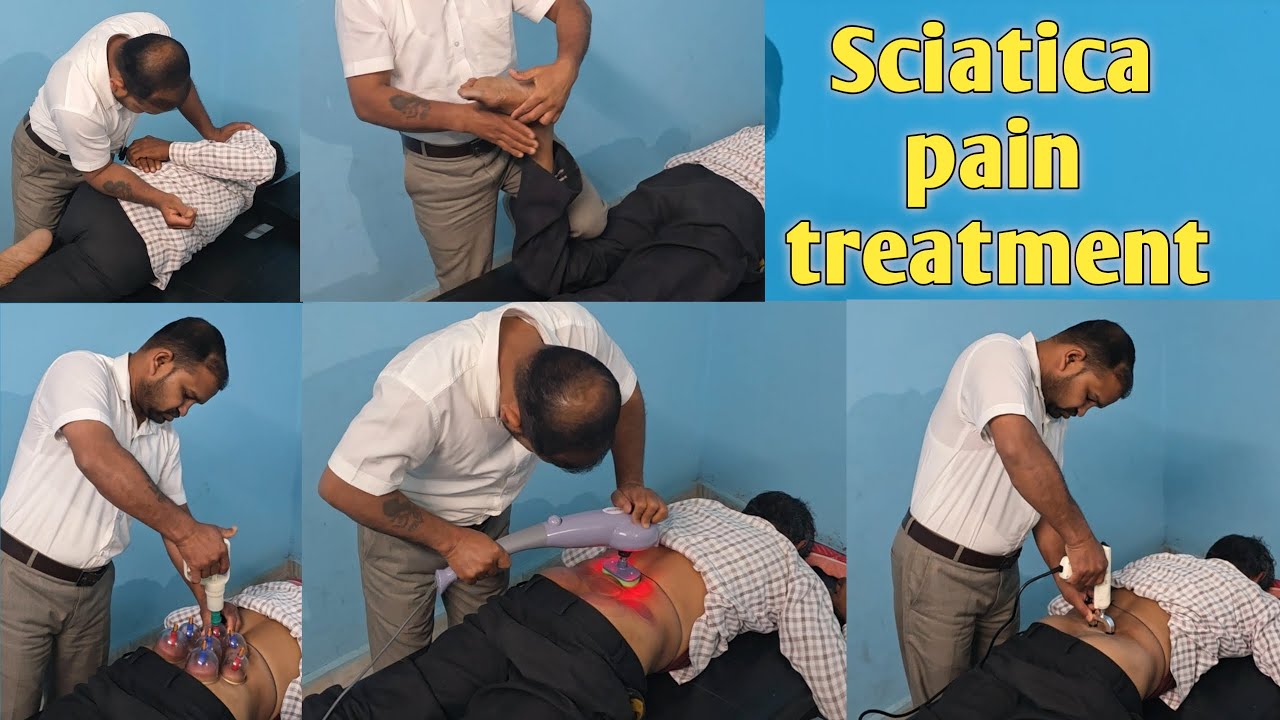 Sciatica pain treatment | cupping therapy and chiropractic adjustment ...