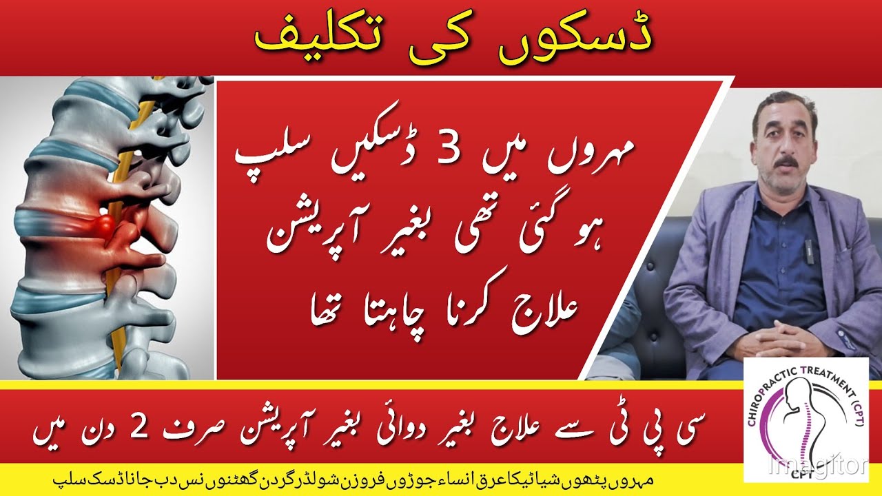 Disc herniation Spinal cord compression treated by Chiropractor Aamir Shahzad CPT clinic - YouTube