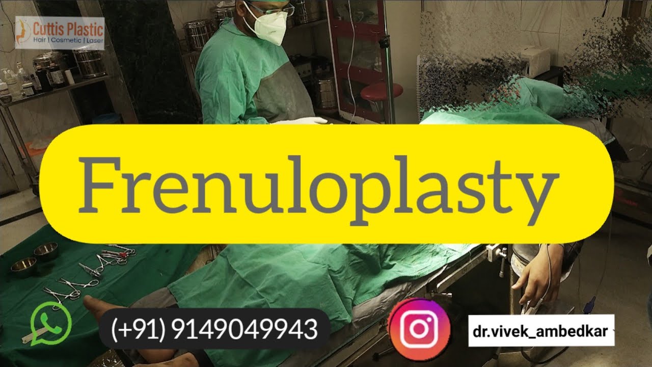 Frenuloplasty | Short Frenulum | Tight Frenulum-Rewa Satna Varanasi ...