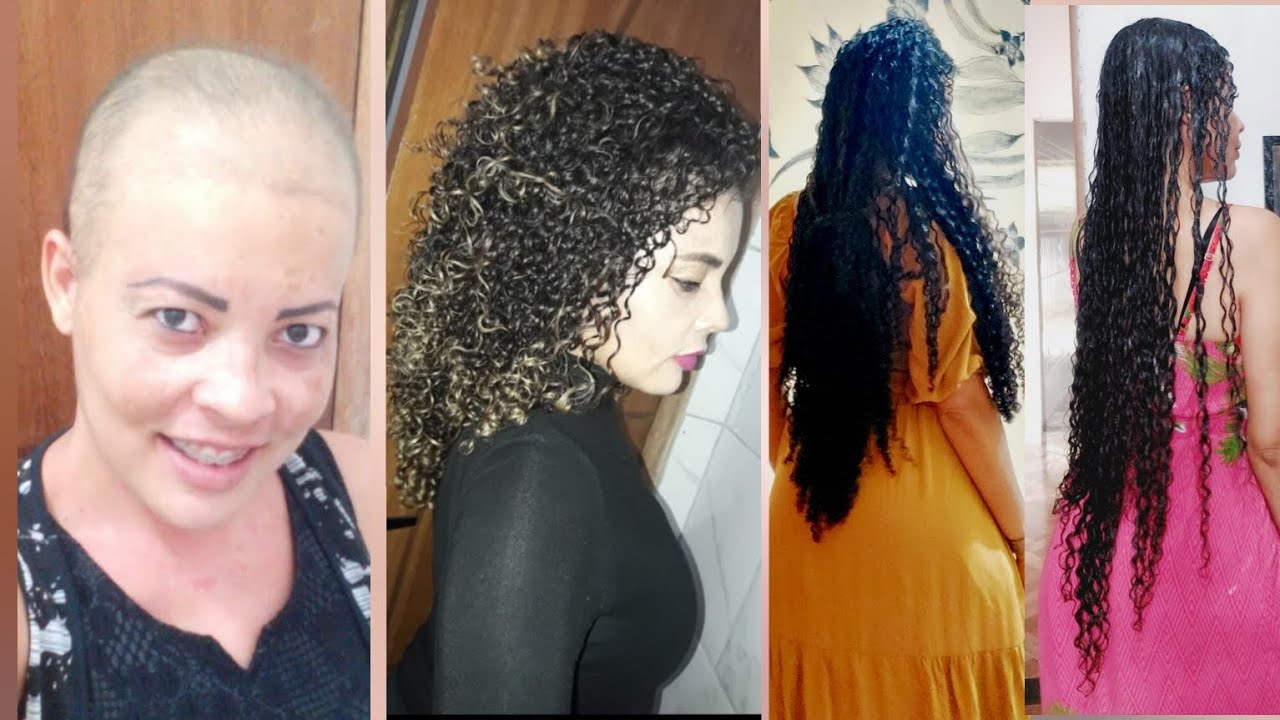 O CRESCIMENTO DO MEU CABELO APÓS O CÂNCER! - YouTube
