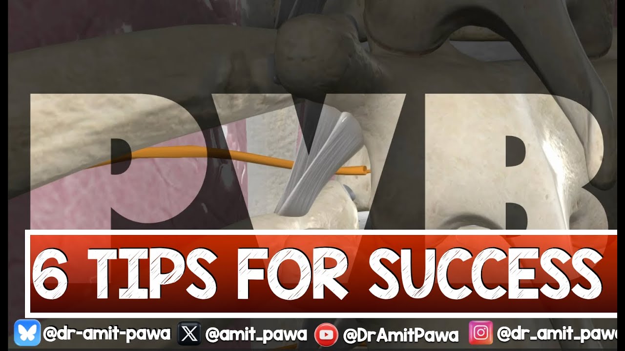 PVB UPDATE - Tips for Success - YouTube