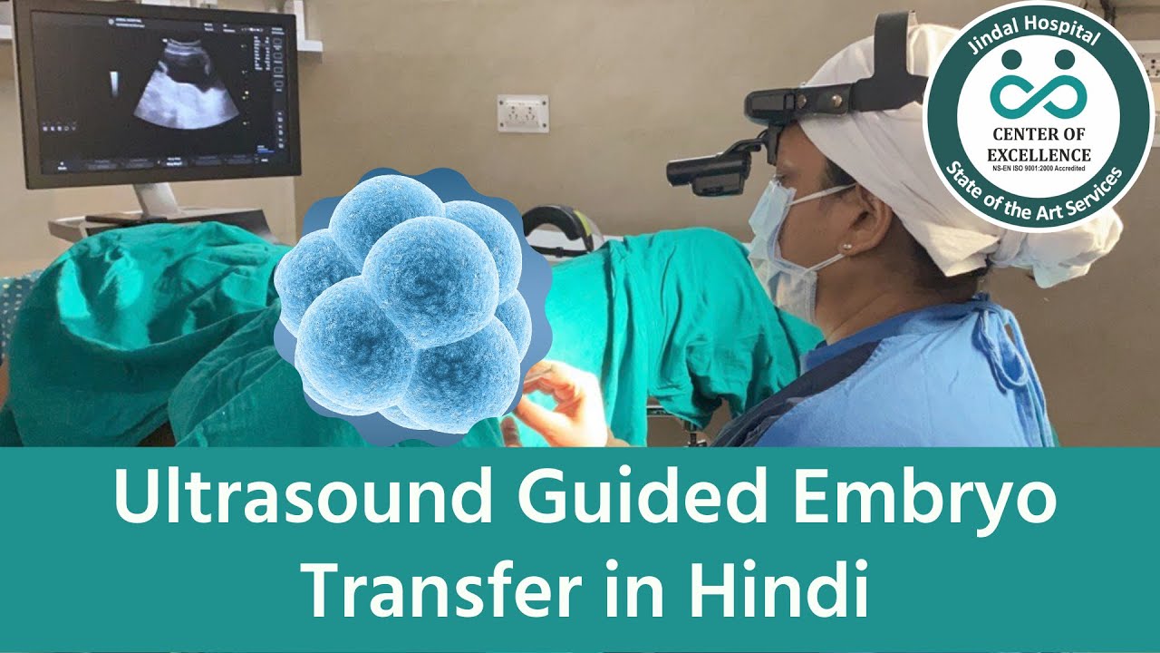 Ultrasound guided embryo transfer - YouTube